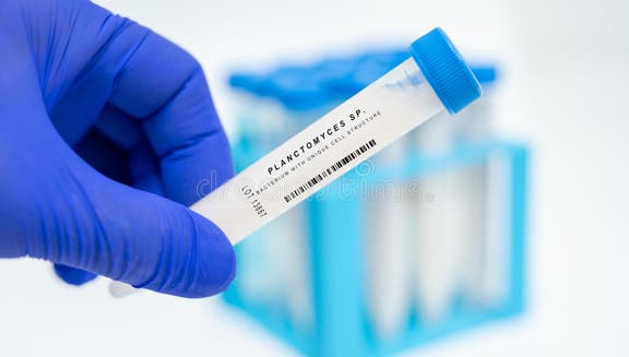 Planctomyces sp stock image. Image of compartmentalized - 362268769