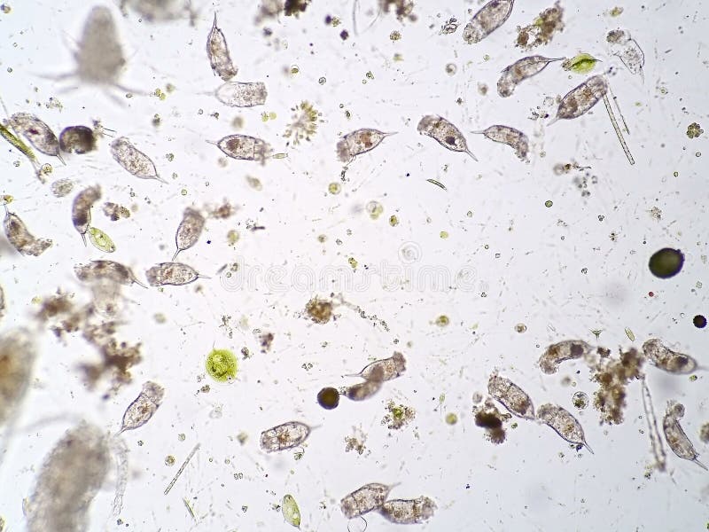 Plancton Aquatique D'eau Douce Image stock - Image du noyau, durée ...