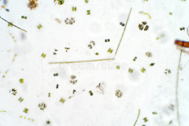 Plancton Aquatique D'eau Douce Sous La Vue De Microscope Image stock ...