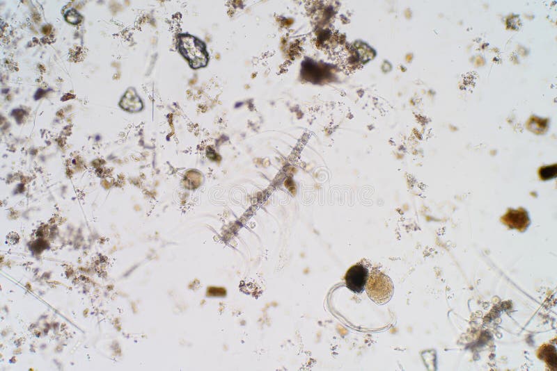 Plancton Aquatique Marin Diatomées Sous L'angle Du Microscope Image ...