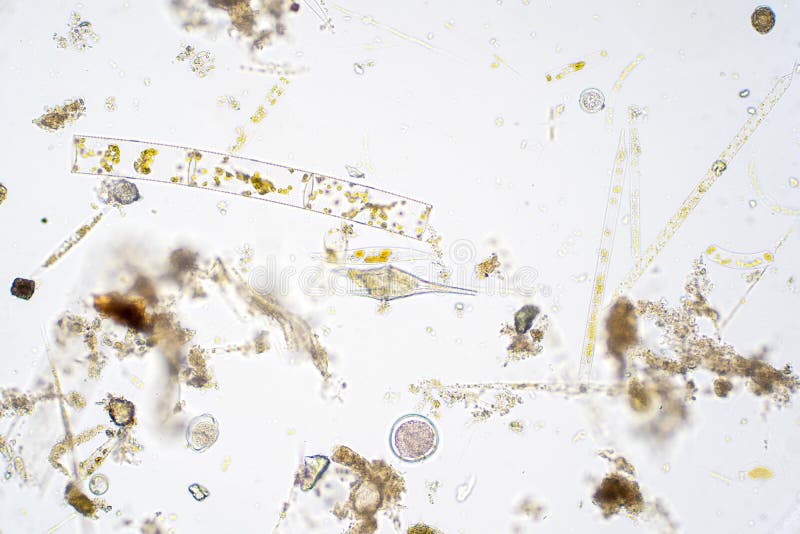 Plancton Aquatique Marin Sous La Vue De Microscope Photo stock - Image ...