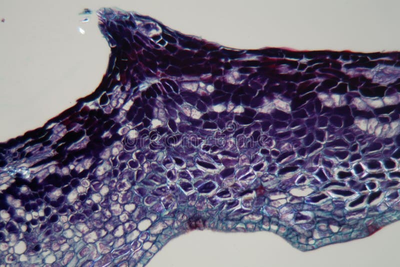 Plant Cells Infected by a Plant Parasite Under the Microscope Stock ...