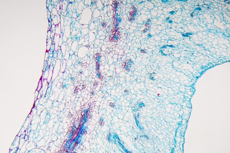 The Plant Pathogen Ustilago Maydis Under the Microscope Stock Photo ...