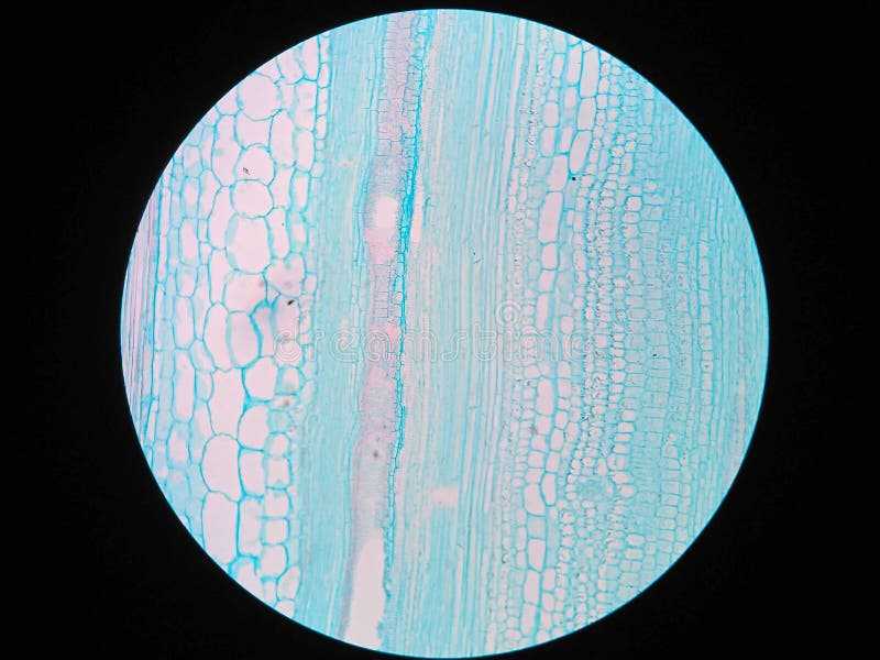 Long Section Plant Vascular Tissue Under the Light Microscope View ...