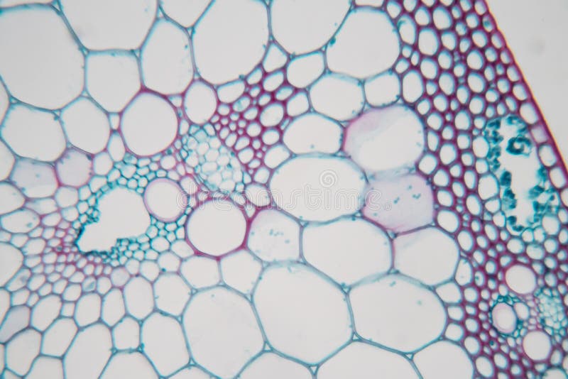 Sclerenchyma Under Microscope