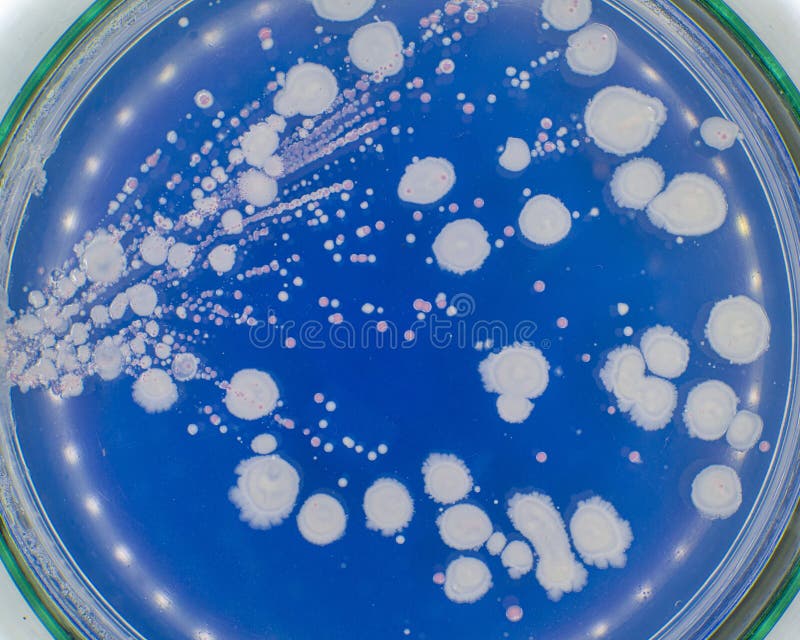 Planting Soil Microflora in a Petri Dish Stock Photo - Image of ...