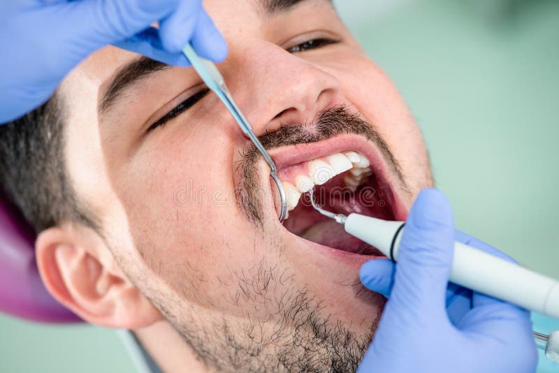 327 Plaque Removal Stock Photos - Free & Royalty-Free Stock Photos from ...