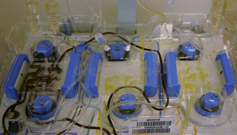 Plasmaphoresis machine stock image. Image of cells, platelets - 1808753