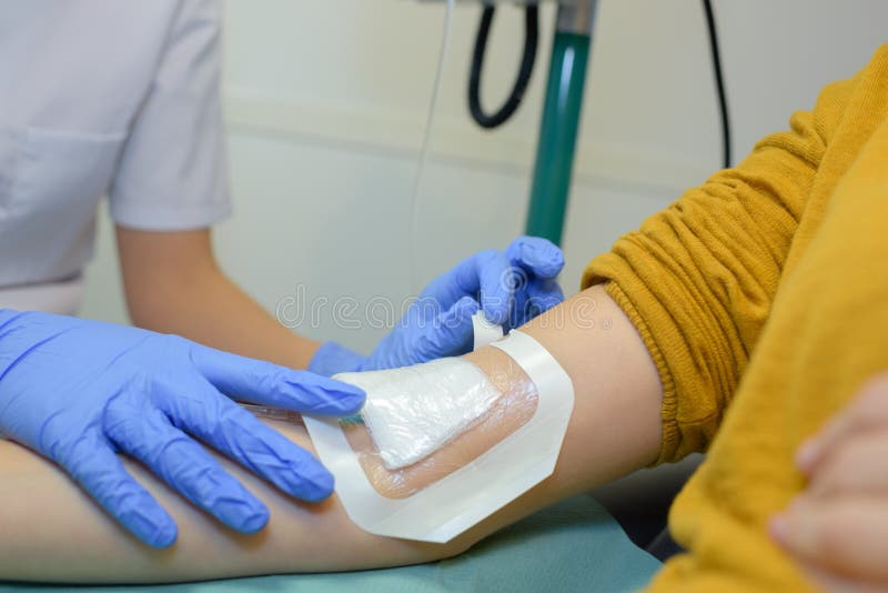 Plaster Being Applied Over Patient`s Arm Stock Image - Image of injury ...