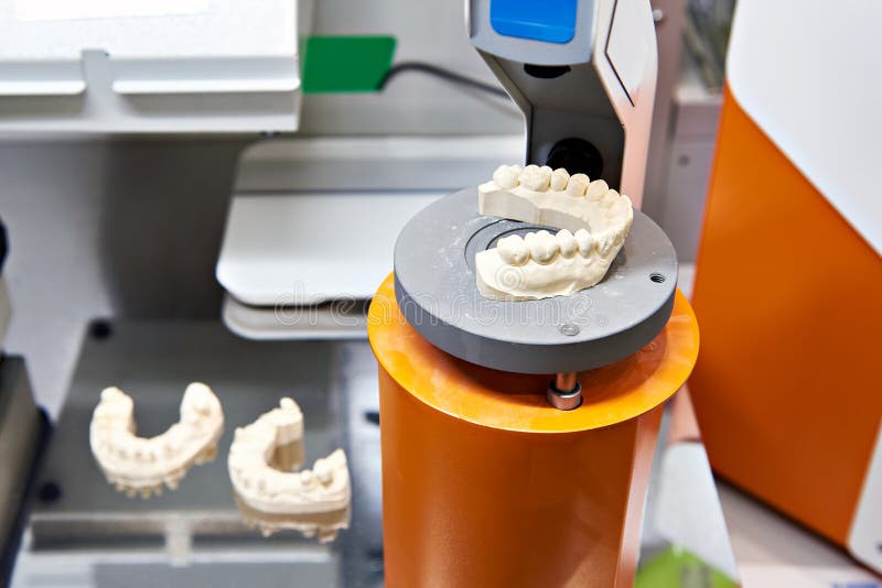 Plaster Cast for Manufacture of Dentures Stock Image - Image of ...