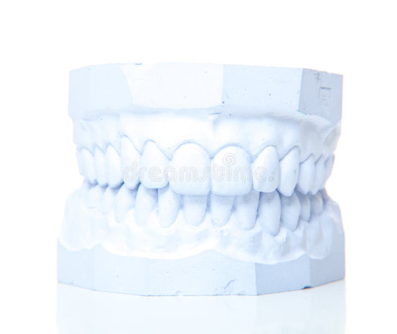 Plaster Cast of Perfect Teeth Stock Photo - Image of healthcare, health ...