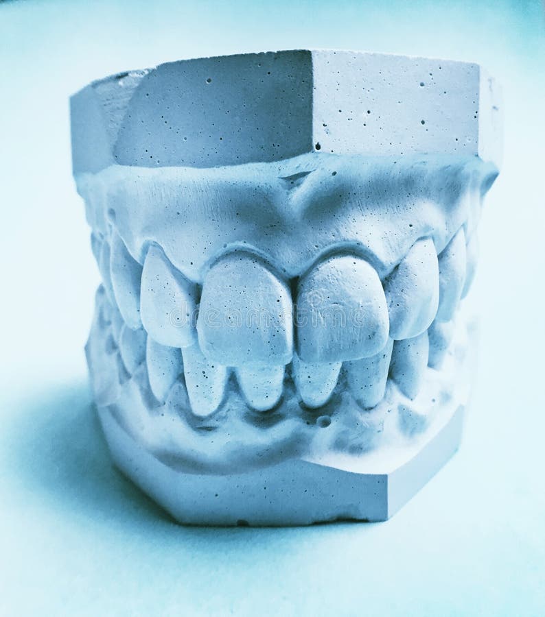 Plaster cast of teeth stock photo. Image of dental, blue - 49904914