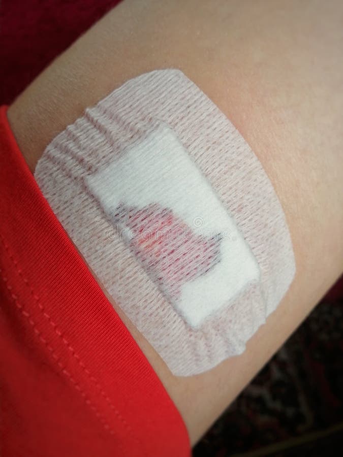 Plaster on a Fresh Wound, Scar, Blood Stock Photo - Image of skin ...