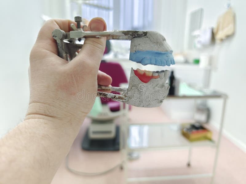Plaster Model with Artificial Teeth for Making a Denture Stock Photo ...