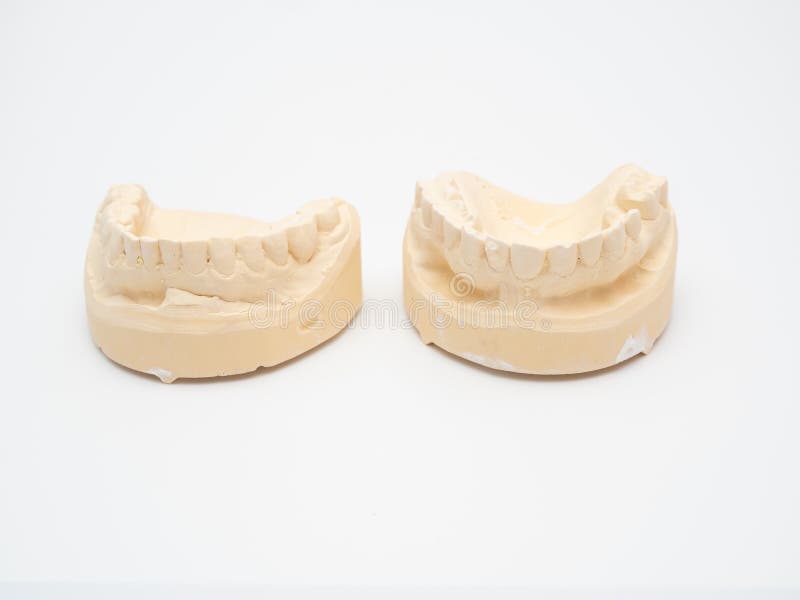 Plaster Model or Cast of Human Teeth. Stock Image - Image of technology ...