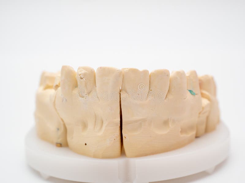 Plaster Model or Cast of Human Teeth. Stock Image - Image of cast ...