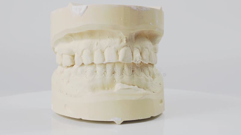 Plaster Model or Cast of Human Teeth. Teeth Model on a White Background ...