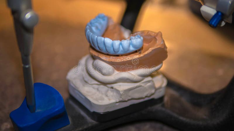 Plaster Model of Teeth, the Work of a Dental Technician, Tools for ...