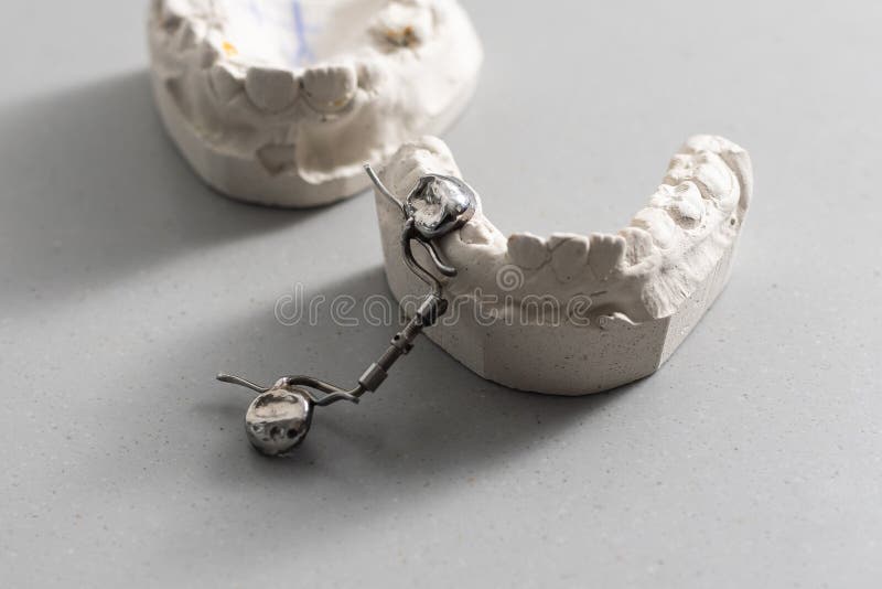 Plaster Models of Dental Prostheses. Demonstration Models of Dentures ...