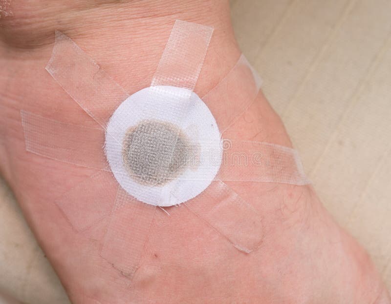 Plaster on foot stock photo. Image of sticky, wound - 102225756