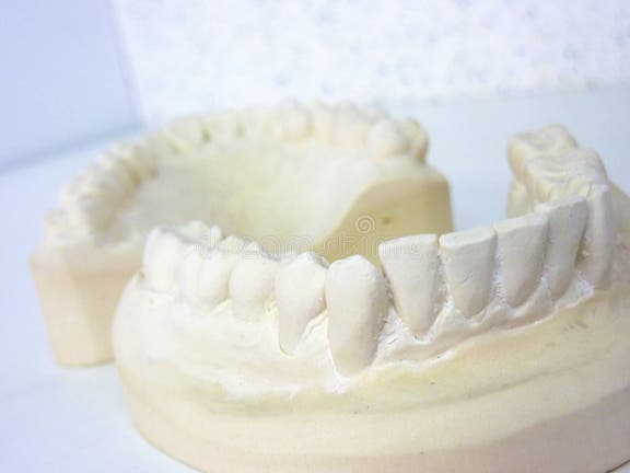 Plaster teeth stock image. Image of hygiene, cavities - 13383201