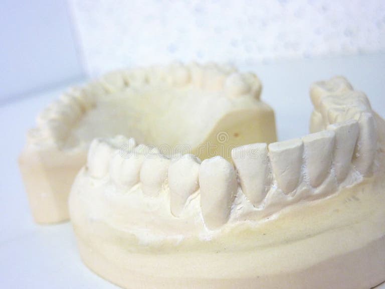 Plaster teeth stock image. Image of hygiene, cavities - 13383201