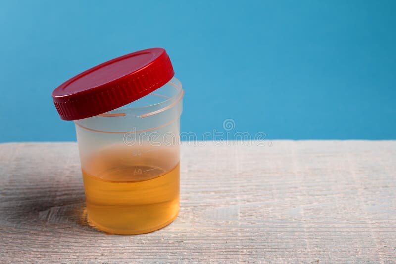 Plastic Container with Urine Analysis on a Blue Background Stock Photo ...