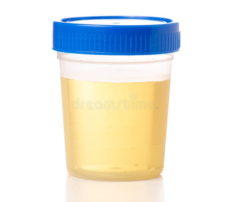 Measuring Urine Output Container