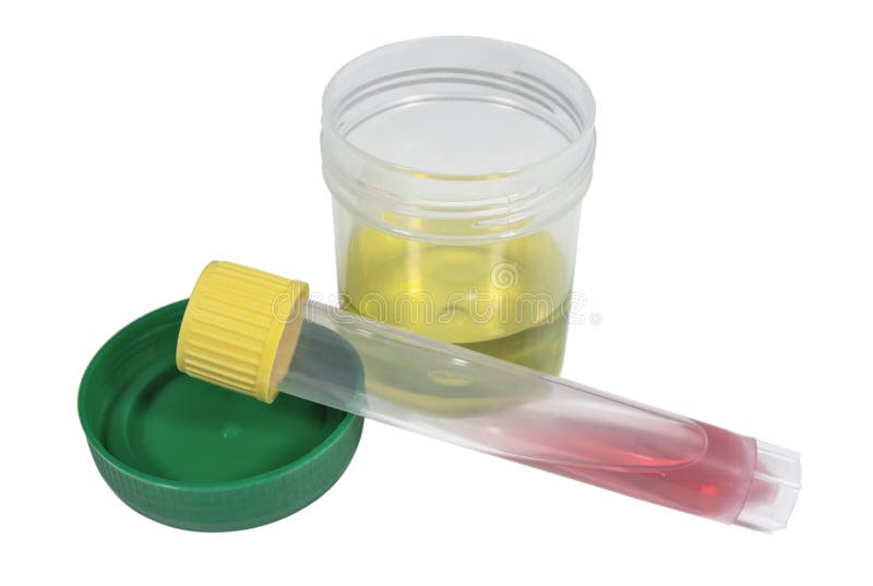 Plastic Containers for Collecting Biological Materials Stock Image ...