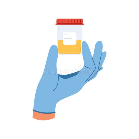 Plastic Containers with Pee Sample. Urine Analysis Stock Vector ...