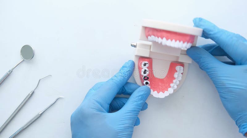 Plastic Dental Teeth Model on White Background Stock Video - Video of ...