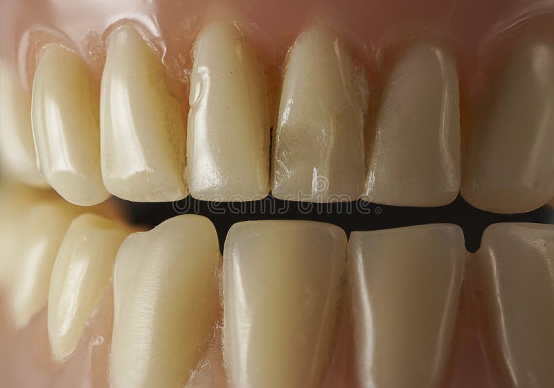 Plastic Dentures with Damage Due To Hard and Long Term Use Stock Image ...