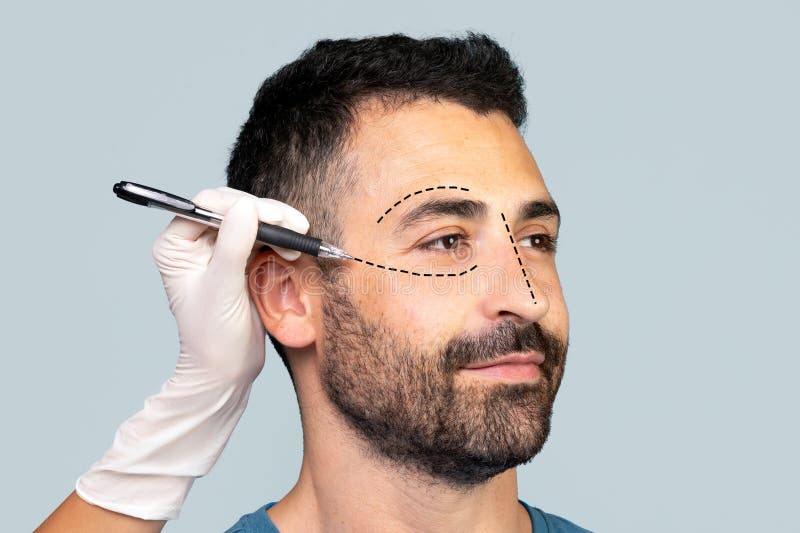 Plastic Surgeon Drawing Marks on Man S Face for Cosmetic Surgery ...