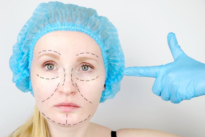 Facial Plastic Surgery or Facelift, Facelift, Face Correction. a ...