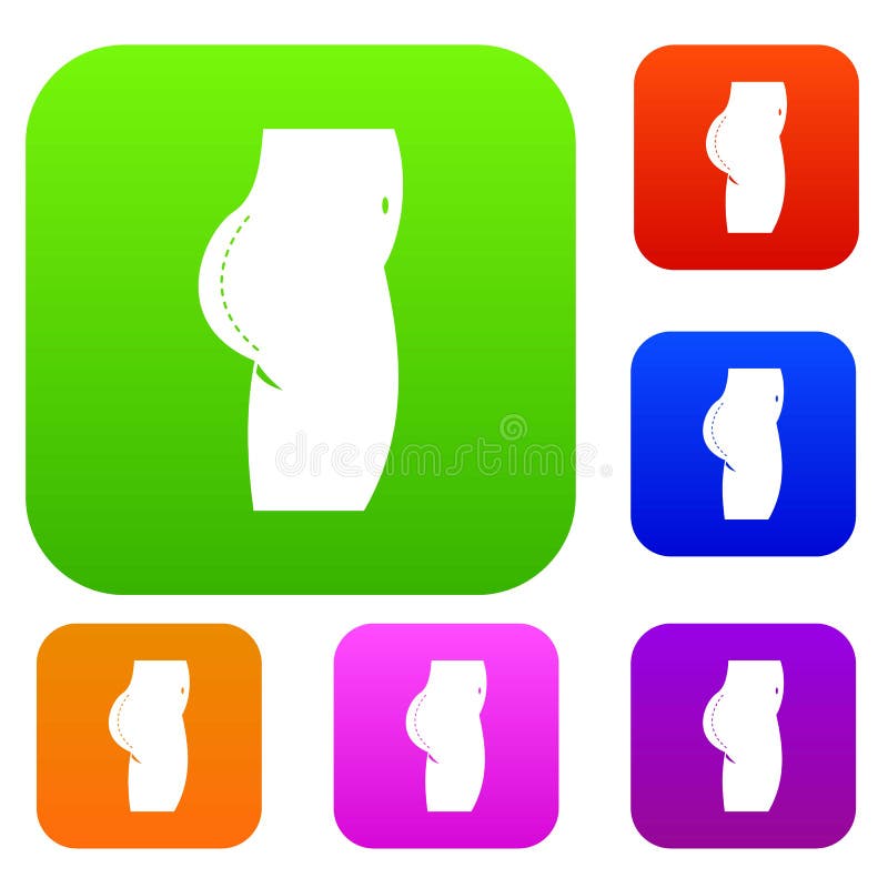 Plastic Surgery of Buttocks Set Color Collection Stock Vector ...