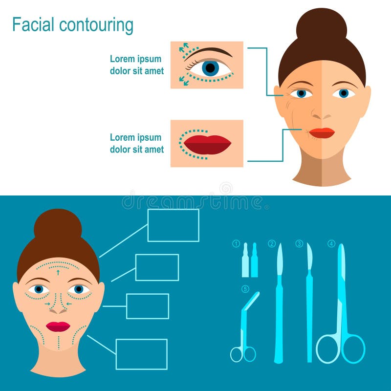 Plastic Surgery of the Face. Infographics Stock Vector - Illustration ...