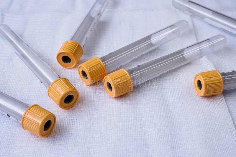Plastic Test Tubes with Caps for the Collection of Samples. Blood ...