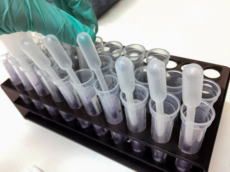 Plastic Tube for Sample Analysis on the Rack Stock Image - Image of ...