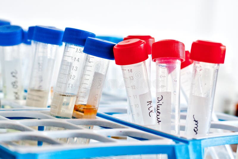 Plastic tubes with diluent stock image. Image of flask - 24225653