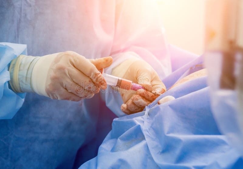 Platelet-Rich Plasma Preparation. Plasma in Syringe. Centrifuge Stock ...