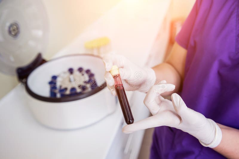 Platelet-Rich Plasma Preparation. Tube with Blood in Hands Stock Photo ...