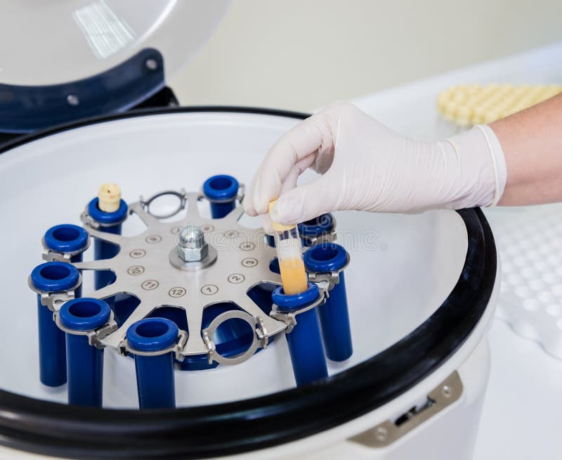Platelet-Rich Plasma Preparation. Tube with Plasma in Hands Stock Photo ... Platelet-Rich Plasma Preparation. Tube with Plasma in Hands Stock Photo ...