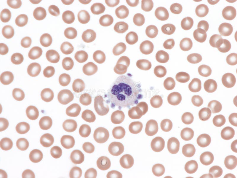 Polymorphonuclear Leucocytes Stock Photos - Free & Royalty-Free Stock ...