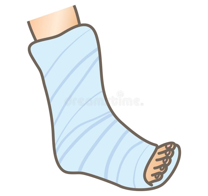 Pleister op het been vector illustratie. Illustration of geduldig ...