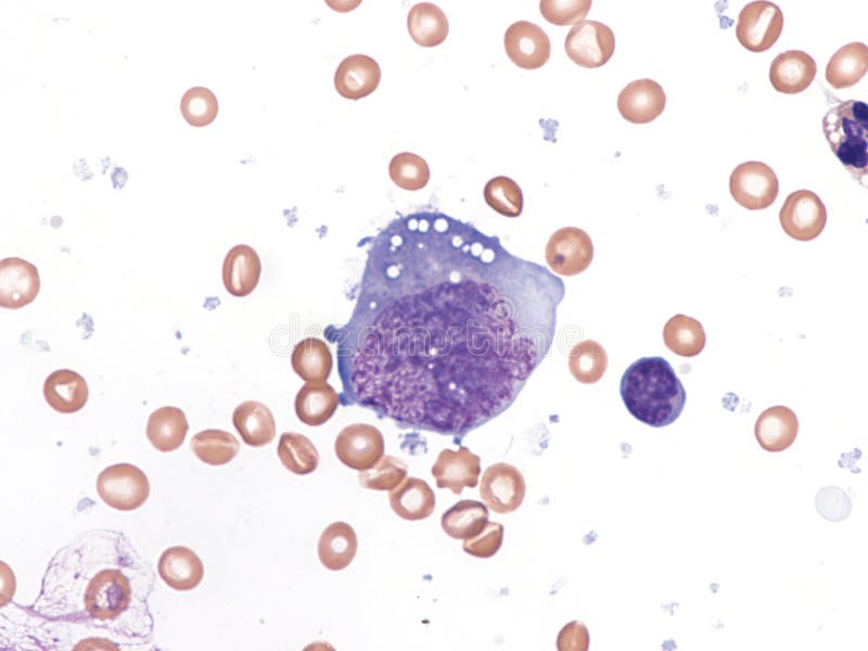 104 Wright X1000 Stock Photos - Free & Royalty-Free Stock Photos from ...