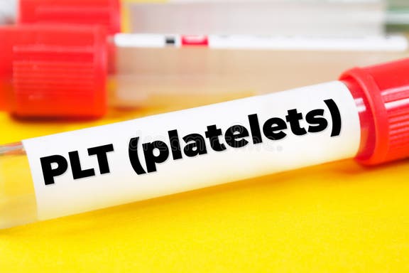 PLT (Platelets) Text Meaning Analysis Stock Image - Image of condition ...
