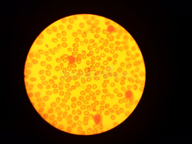 PLT stock photo. Image of medical, illness, clinical - 52412492