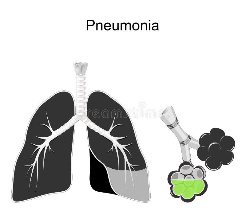 Alveolus of Human Lungs, Oxygen and Carbon Dioxide Move in Alveoli ...