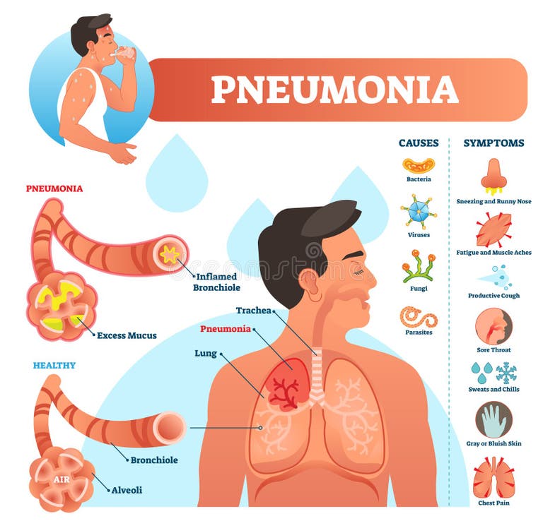 Respiratory System Diagram Labeled Stock Illustrations – 58 Respiratory ... Respiratory System Diagram Labeled Stock Illustrations – 58 Respiratory ...