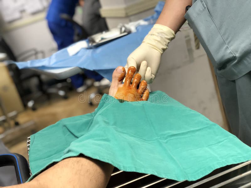 Podiatric Surgery Operation in E.R Stock Photo - Image of healthcare ...